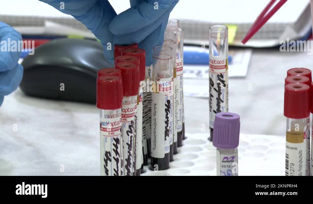 Pouring blood Stock Videos & Footage - HD and 4K Video Clips - Alamy