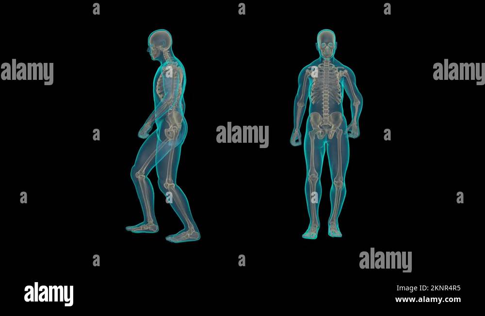 Human walking x ray Stock Videos & Footage - HD and 4K Video Clips - Alamy