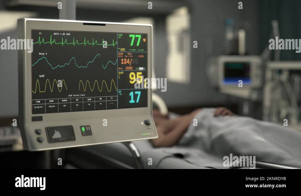 Heart monitoring device ecg machine Stock Videos & Footage - HD and 4K ...