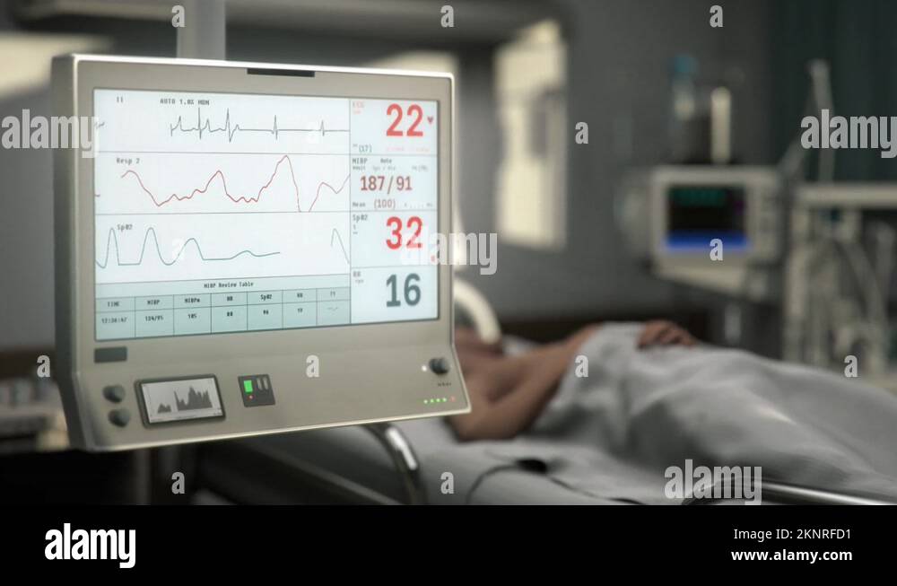 Modern Pulse Monitoring Computer Shows Death Of Patient From Heart ...