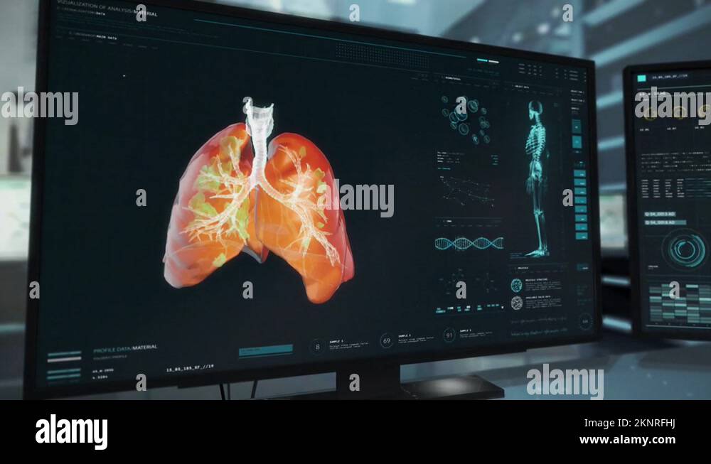 Lung scans Stock Videos & Footage - HD and 4K Video Clips - Alamy
