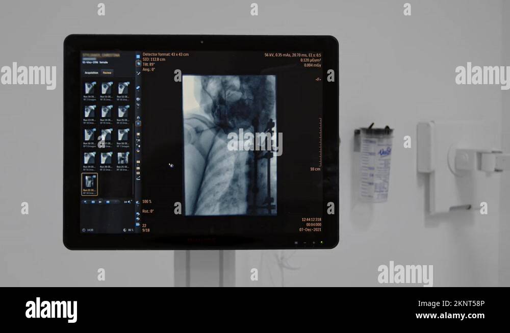 Pet ct scan monitor Stock Videos & Footage - HD and 4K Video Clips - Alamy