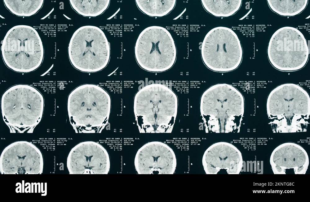 X-ray, Magnetic resonance image of head. Doctor examining human brain ...