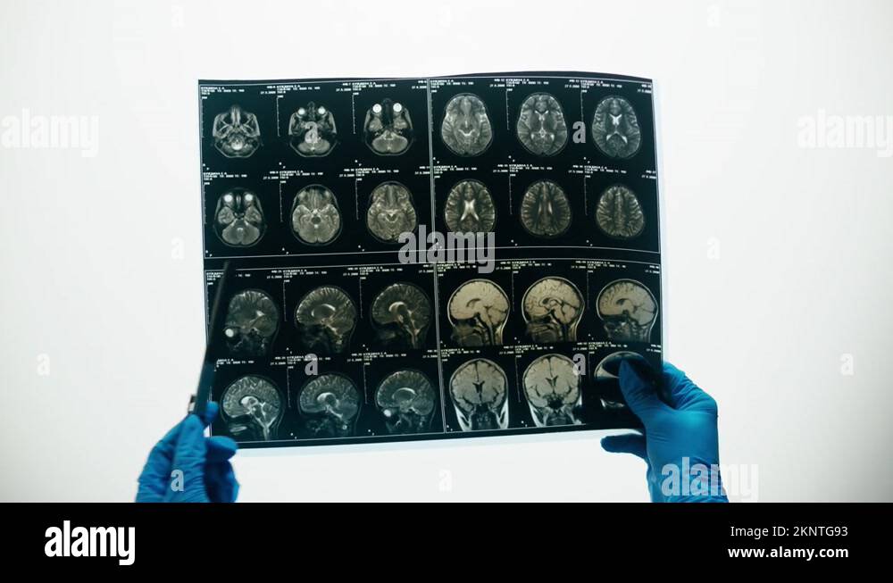 X-ray, Magnetic resonance image of head. Doctor examining human brain ...