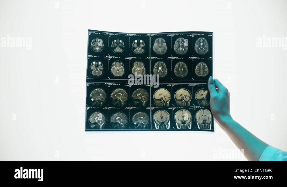 X-ray, Magnetic resonance image of head. Doctor examining human brain ...
