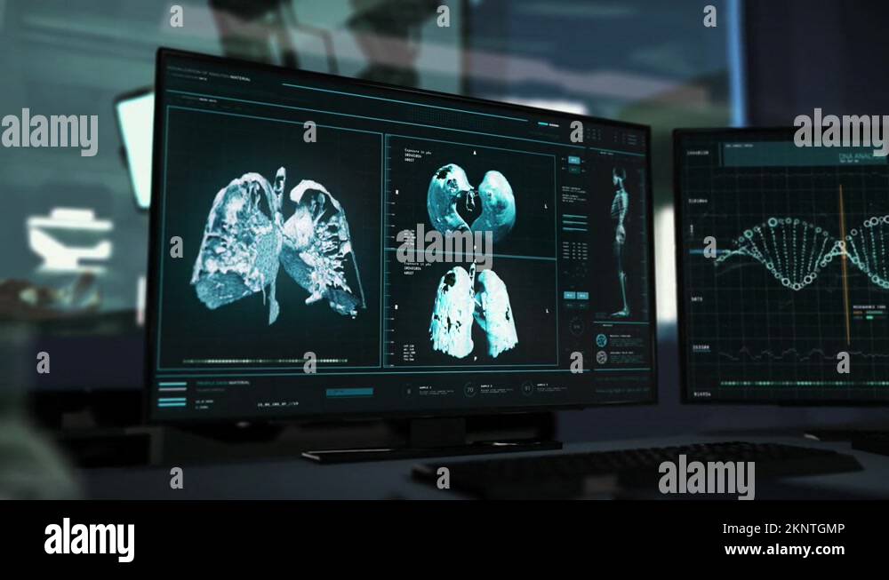 Futuristic X-ray Screening Device Analyzes Lung Organ To Diagnose ...