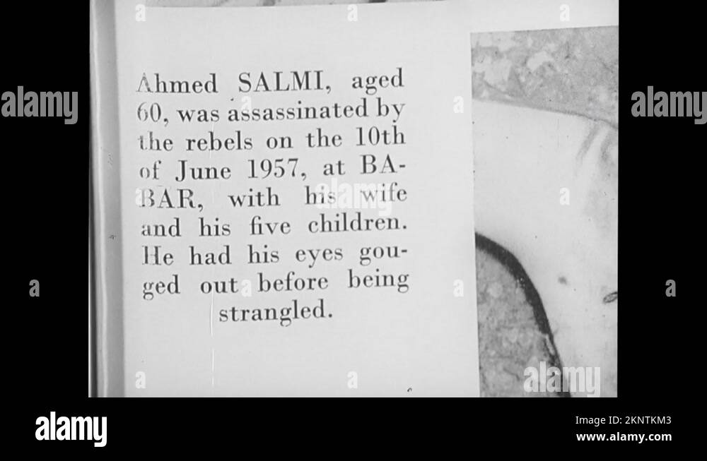 Algeria 1950s: Photographs of FLN atrocities: Man with eyes gouged out ...