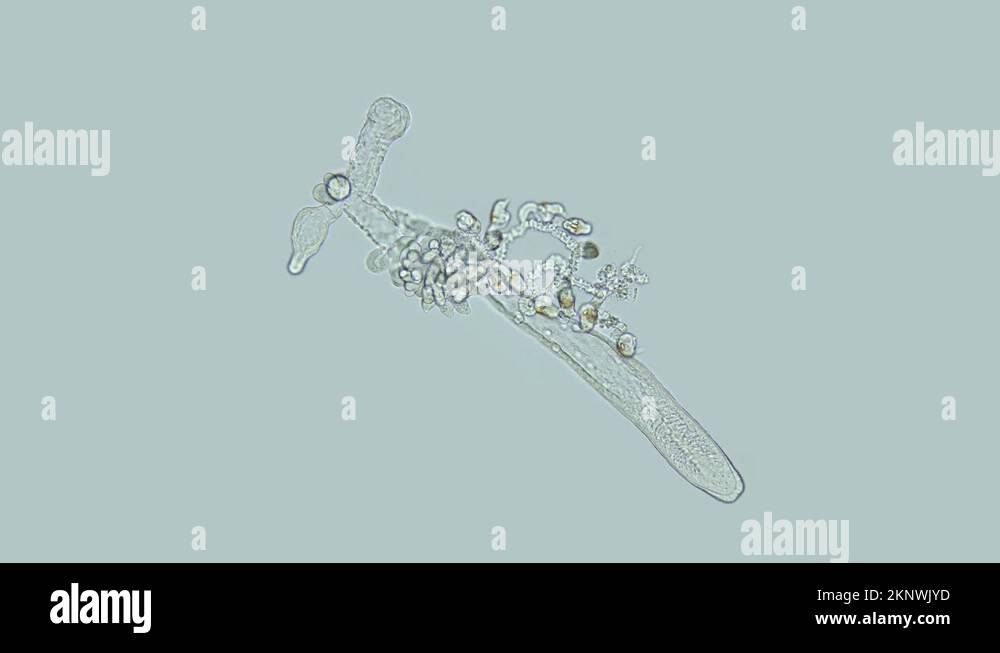 Siphonophora Stock Videos & Footage - HD and 4K Video Clips - Alamy