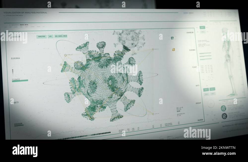 Scan system interface identifies the covid-19 illness after lung ...