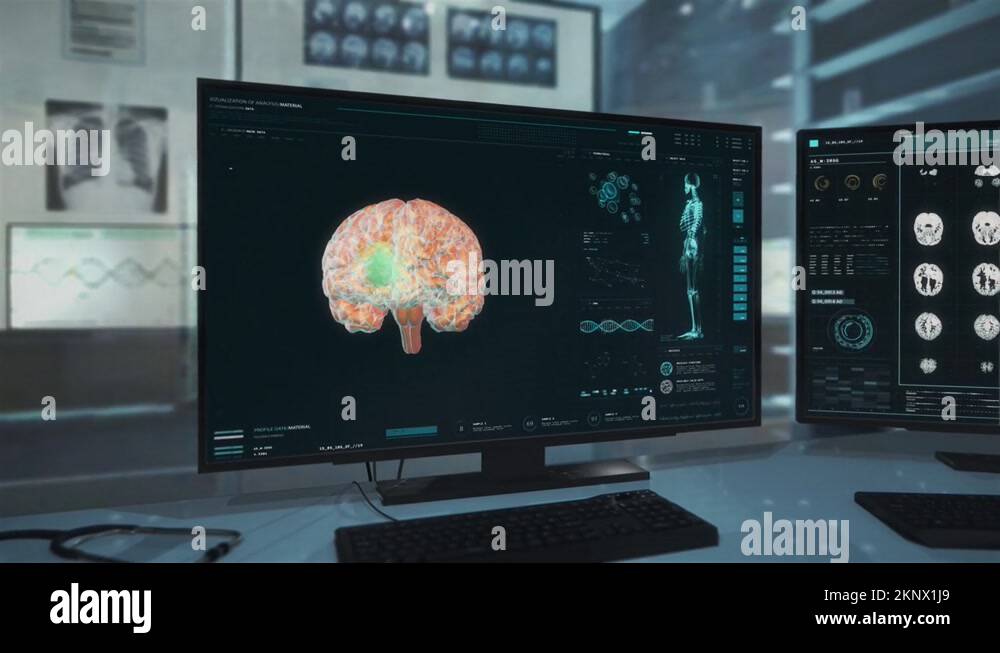 Anatomical head brain model Stock Videos & Footage - HD and 4K Video ... Anatomical head brain model Stock Videos & Footage - HD and 4K Video ...