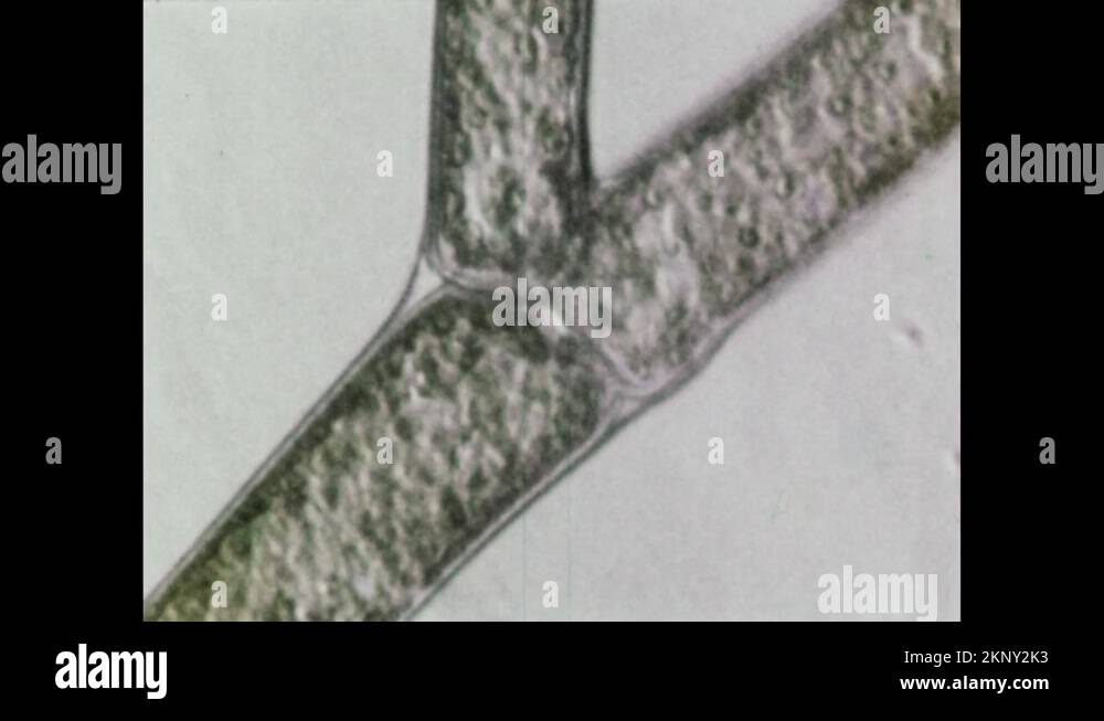 1960s: Algae on an underwater rock. Microscopic view of algae cells ...