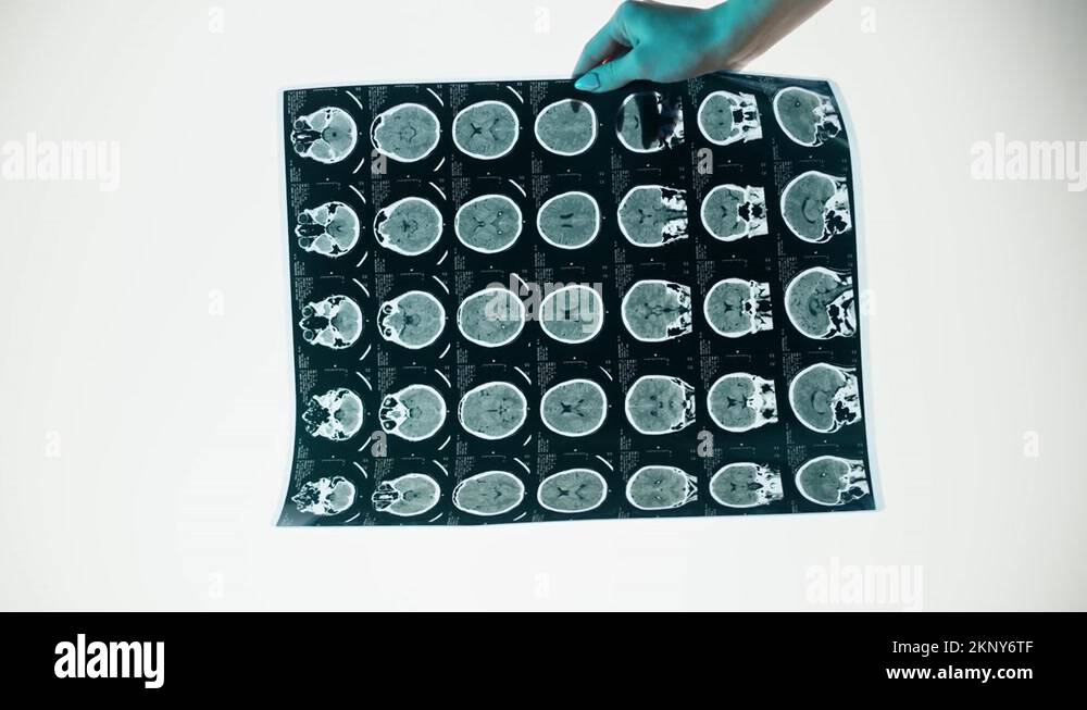 X-ray, Magnetic resonance image of head. Doctor examining human brain ...