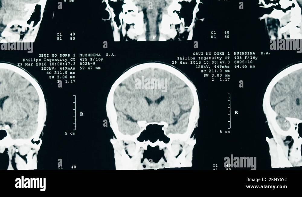 X-ray, Magnetic resonance image of head. Doctor examining human brain ...