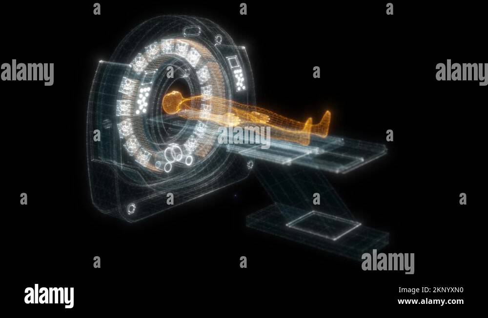 Digital MRI scan with patient Hologram. Medicine and Technology Concept ...