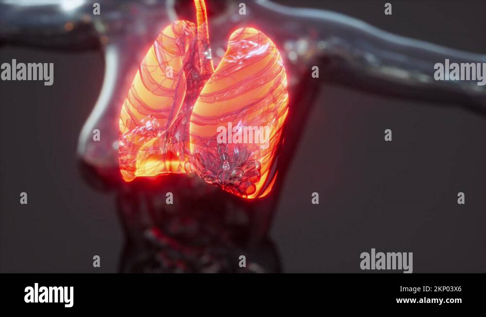 Hologram of inflamed lungs in the human body Stock Video Footage - Alamy
