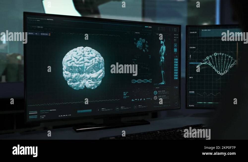 Advanced X-ray Scanner Equipment Interface Scans Human Head At A ...