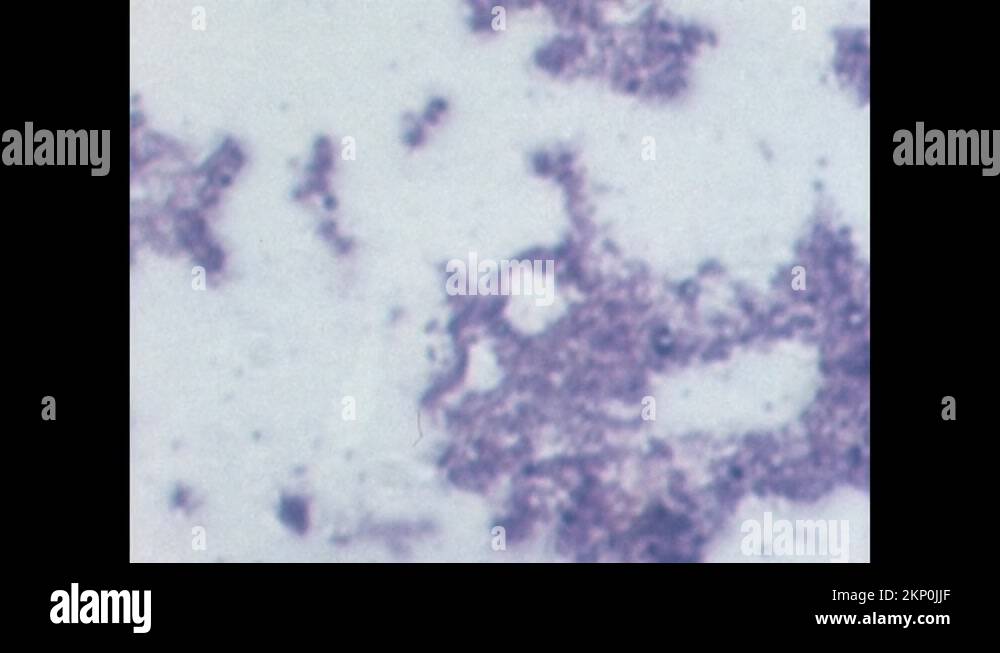 1940s: Cluster of spores are magnified on microscope slide. Japanese ...