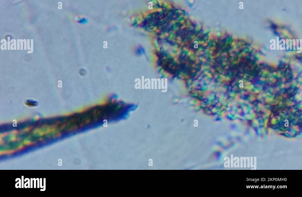 Close up infectious contaminated microbe cell bacteria under microscope ...