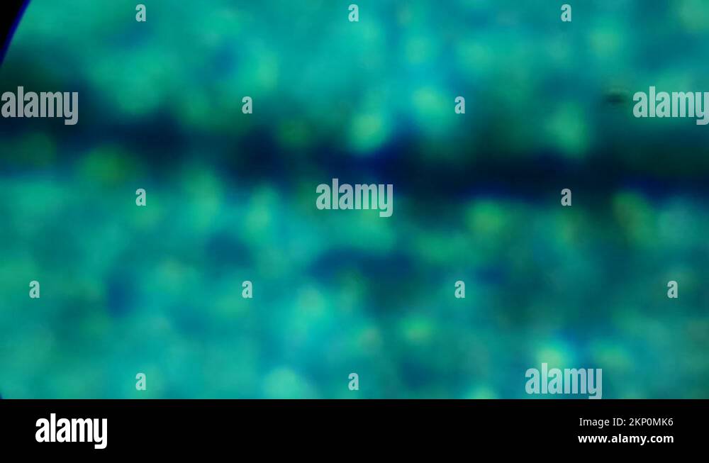 Close up biotechnology sample cell strands micro organism under ...