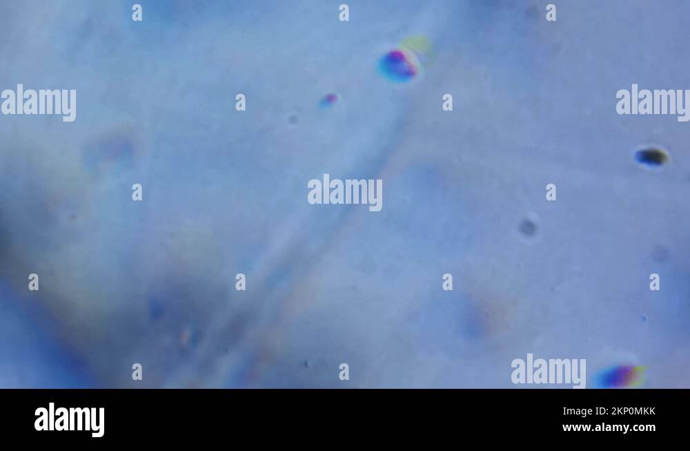 Microscope magnification close up viral bacteria micro organism ...
