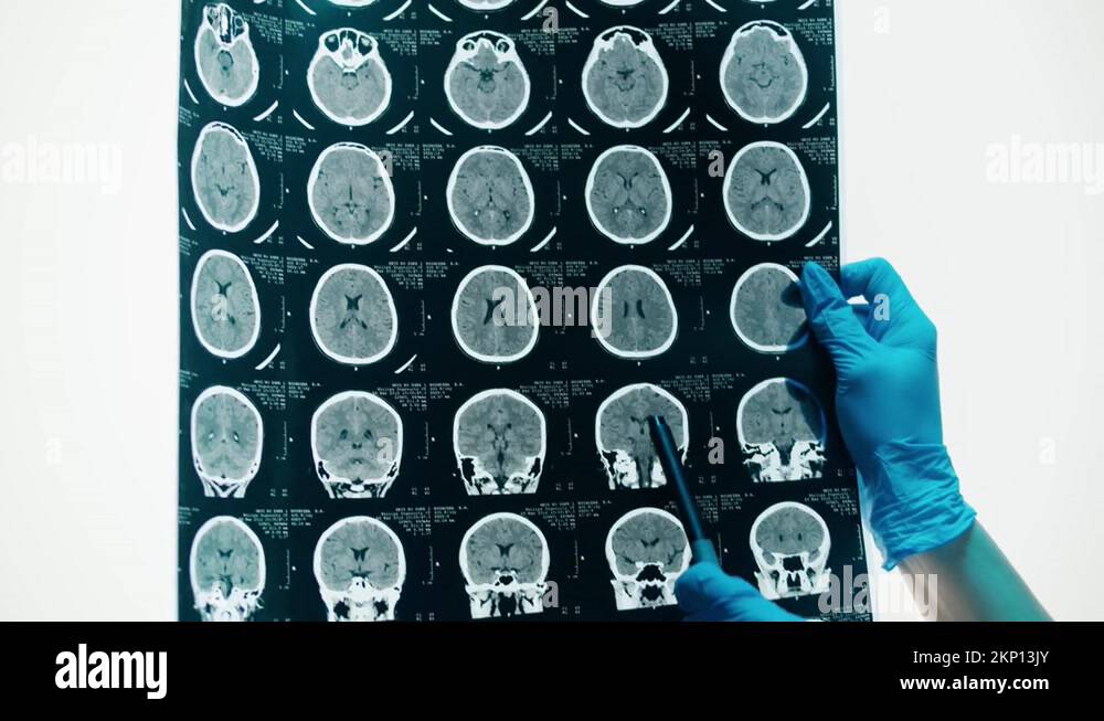 X-ray, Magnetic resonance image of head. Doctor examining human brain ...