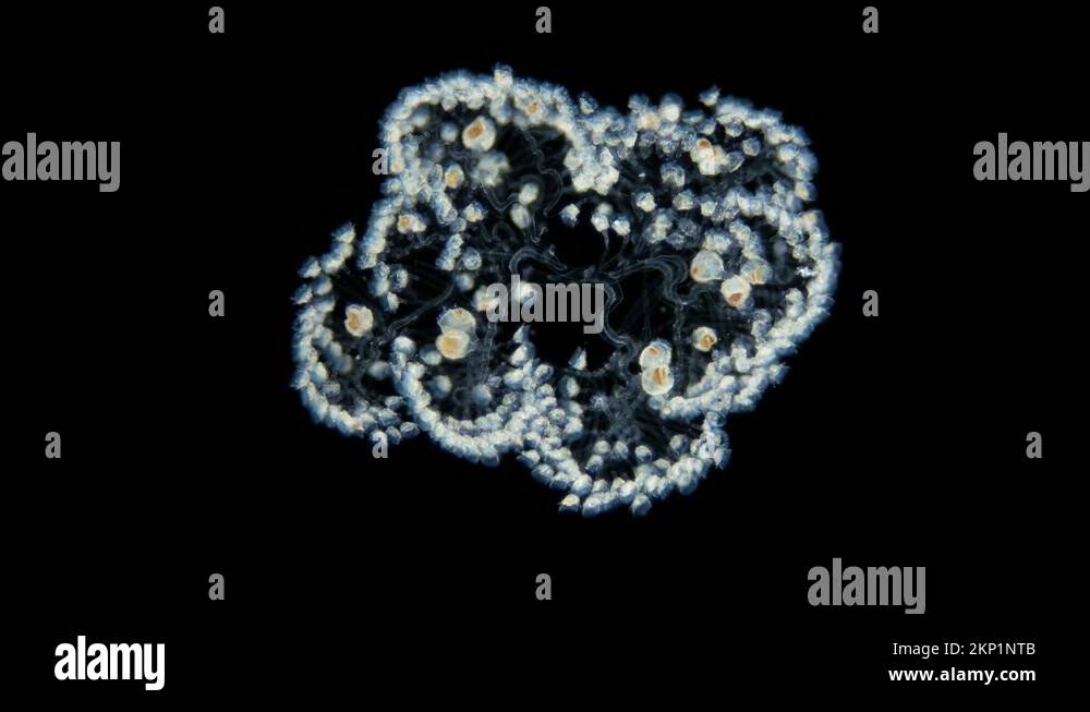 Infusoria Ciliophora Peritrichia under microscope, order Sessilida ...