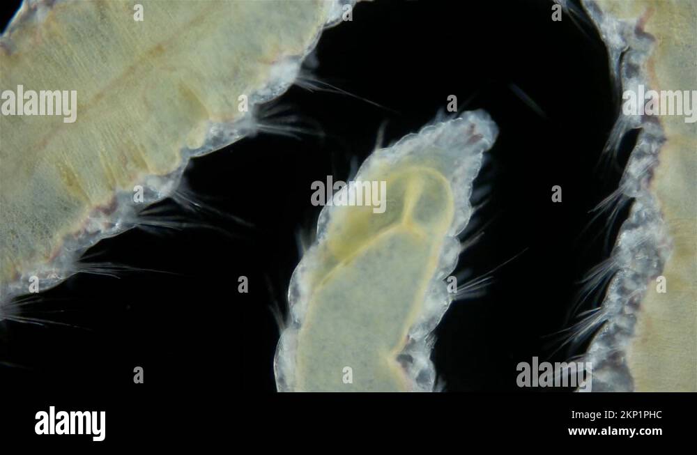Worm Polychaeta family Amphinomidae under a microscope. Possibly Genus ...