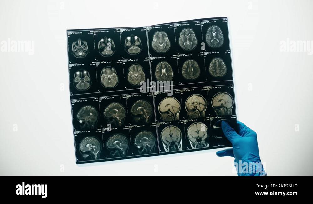 X-ray, Magnetic resonance image of head. Doctor examining human brain ...