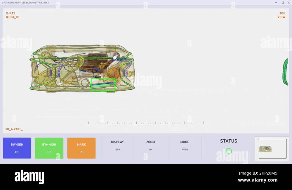 Passenger Baggage X-Ray Projection Surveillance Device At International ...