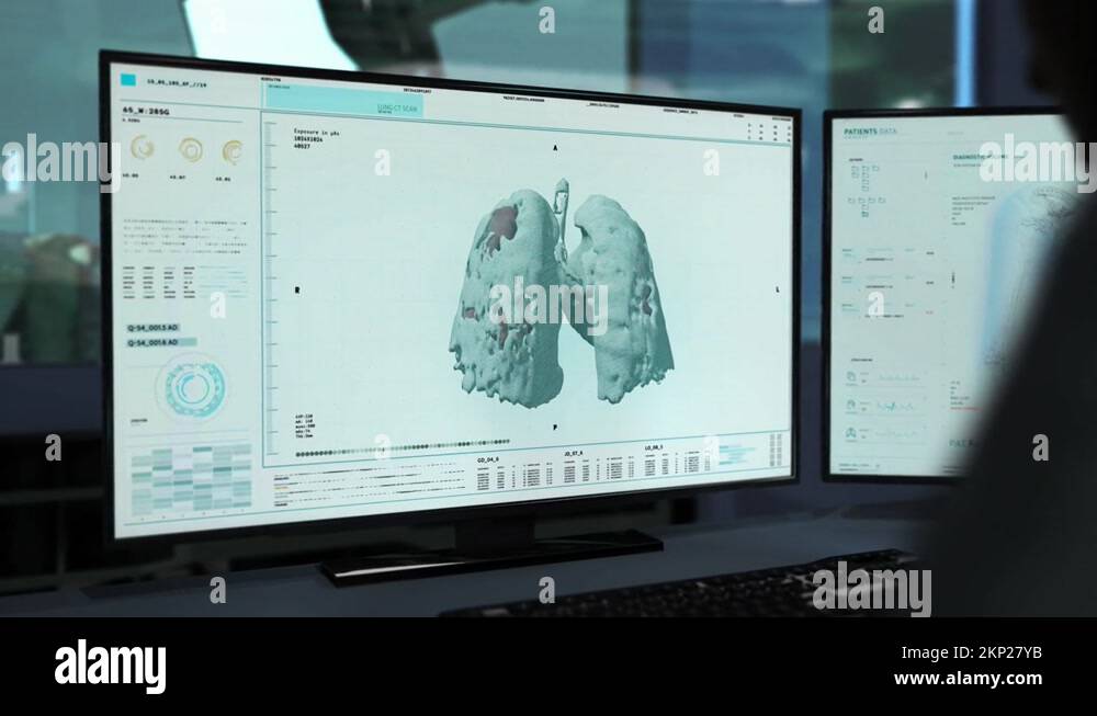 High Tech Health Care Examination Using X-Ray Medical Analysis Scanner ...