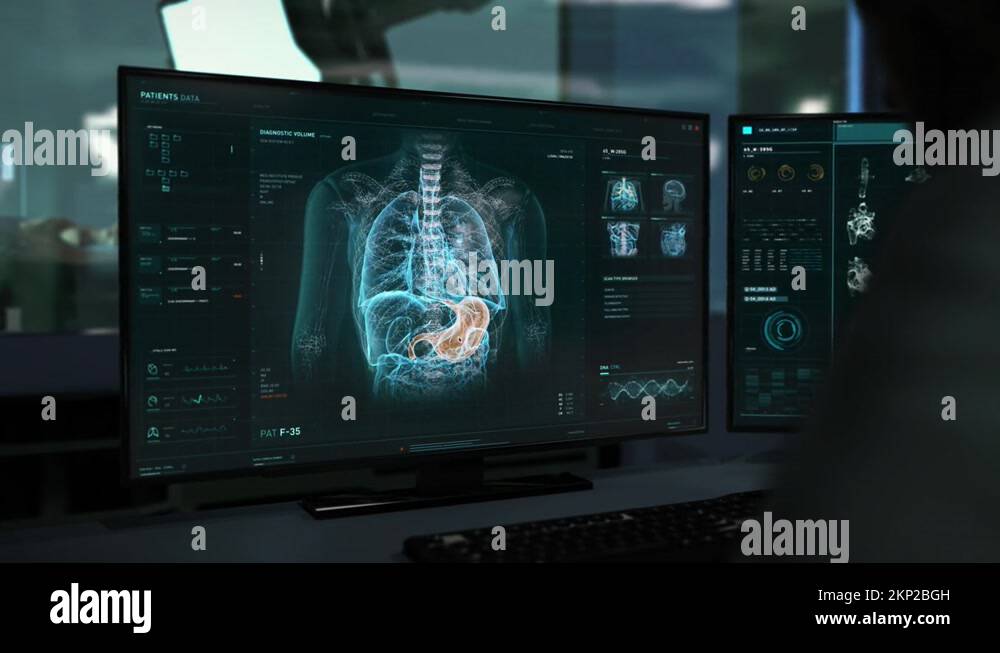 Innovative Medical Analysis System Interface Diagnoses Cardiac Ischemia ...