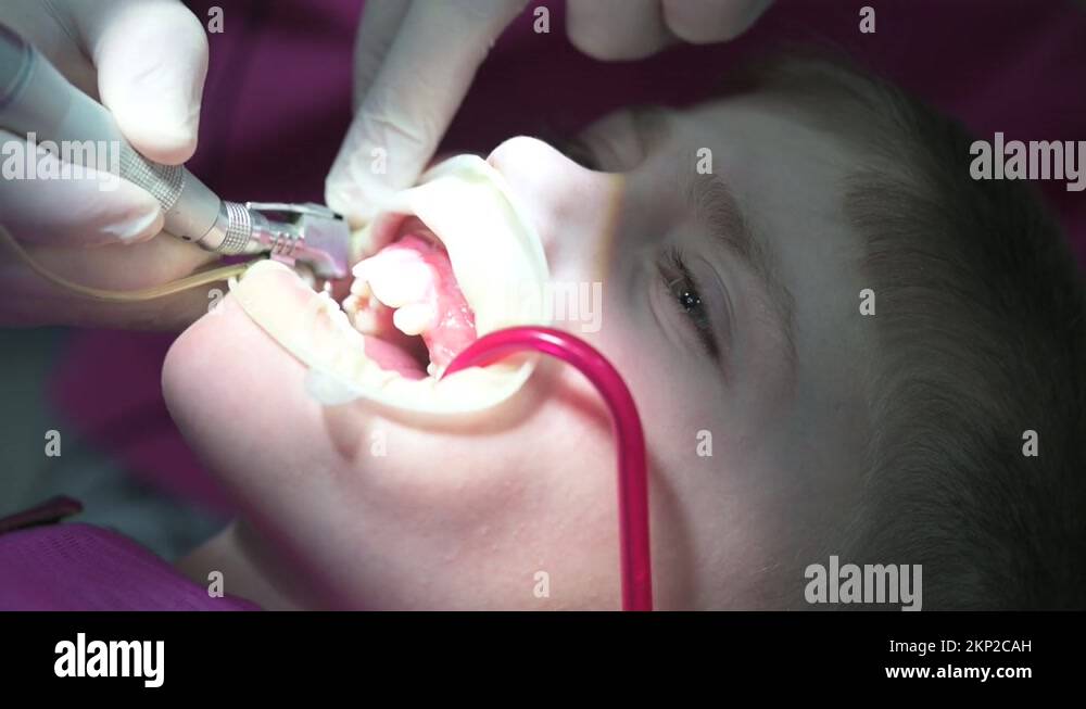 Baby tooth caries Stock Videos & Footage - HD and 4K Video Clips - Alamy