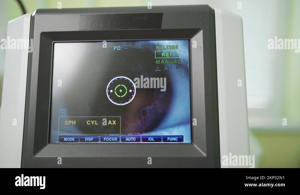 eye on the screen of the autorefractometer. a modern ophthalmic device ...