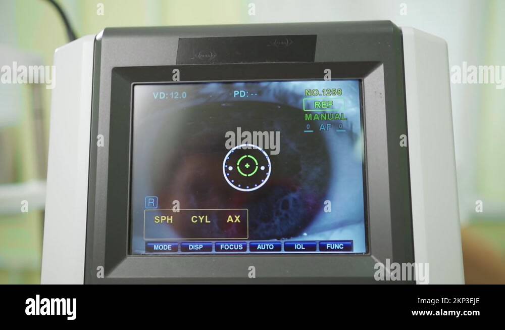 eye on the screen of the autorefractometer. a modern ophthalmic device ...