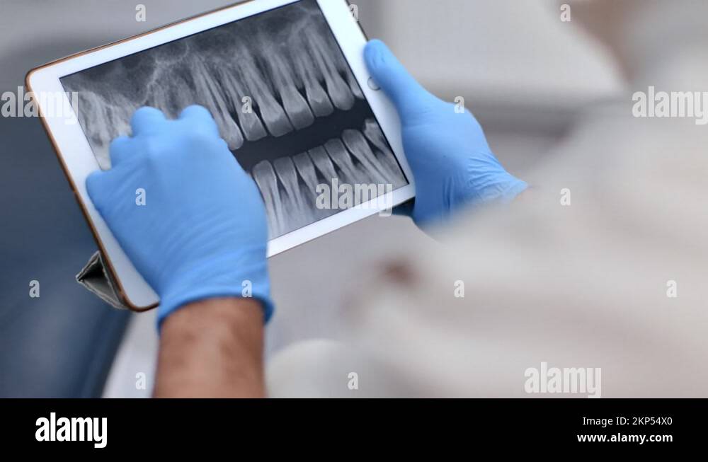 Roentgen male Stock Videos & Footage - HD and 4K Video Clips - Alamy