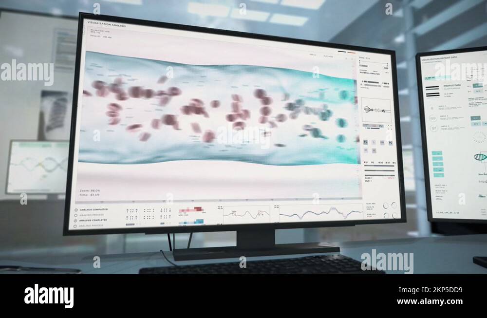 Microscopic Medical Analysis Of Patients Veins Determines First Blood ...