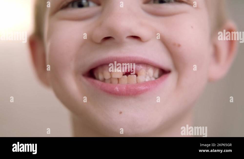 Toothless smile Blonde caucasian baby boy without milk tooth in mouth ...