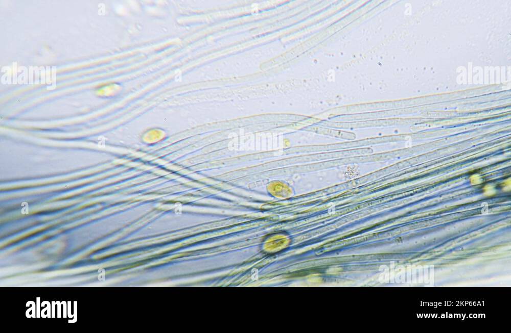 Cyanobacteria and green algae movement under microscope Stock Video ...