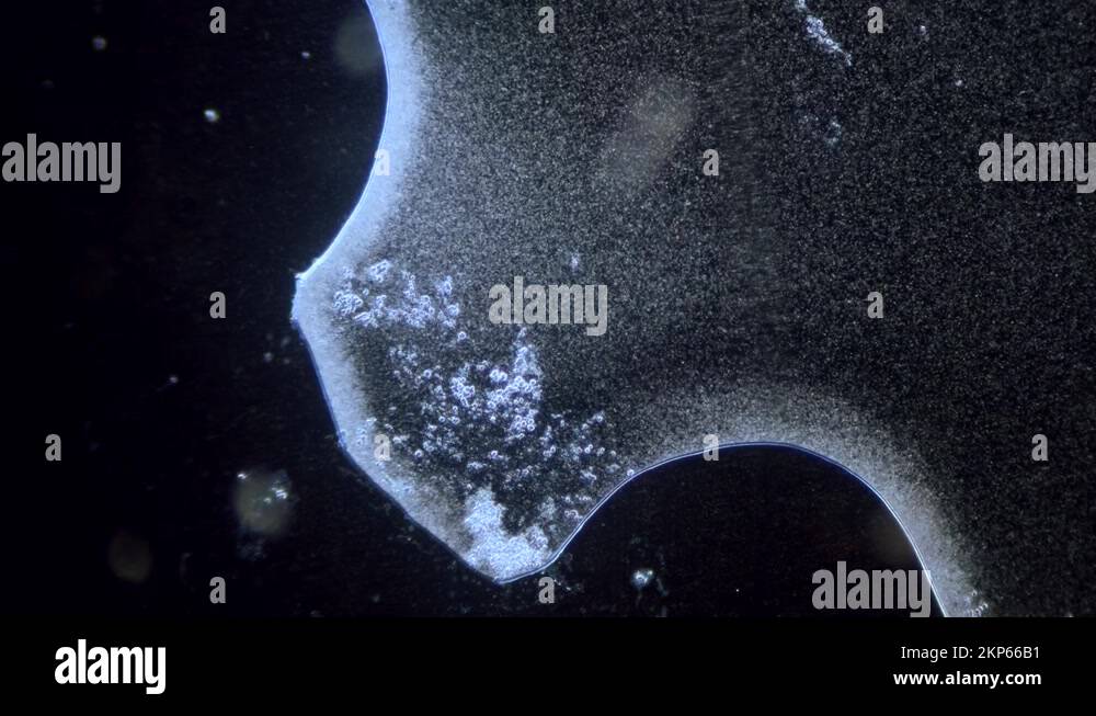 Chlamydomonas microscope Stock Videos & Footage - HD and 4K Video Clips ...