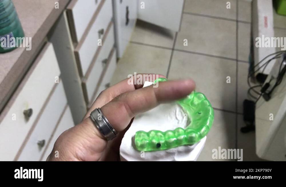 Dentist splint Stock Videos & Footage - HD and 4K Video Clips - Alamy