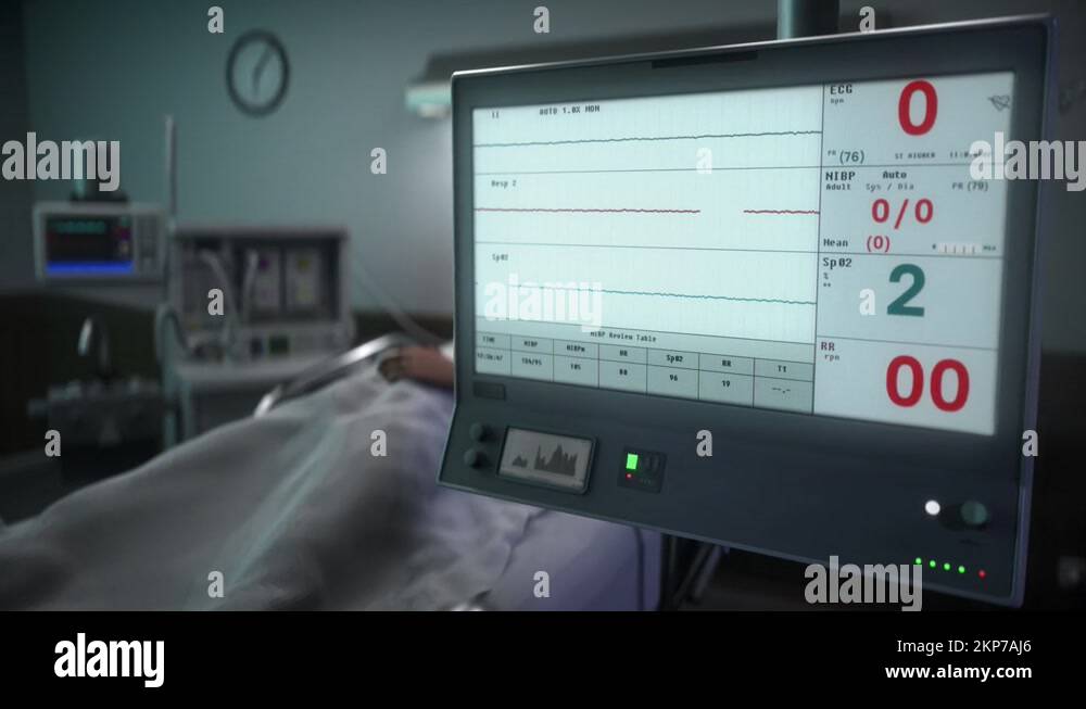 Electronic Vital Signs Monitoring Equipment Detects Patient Dying From ...