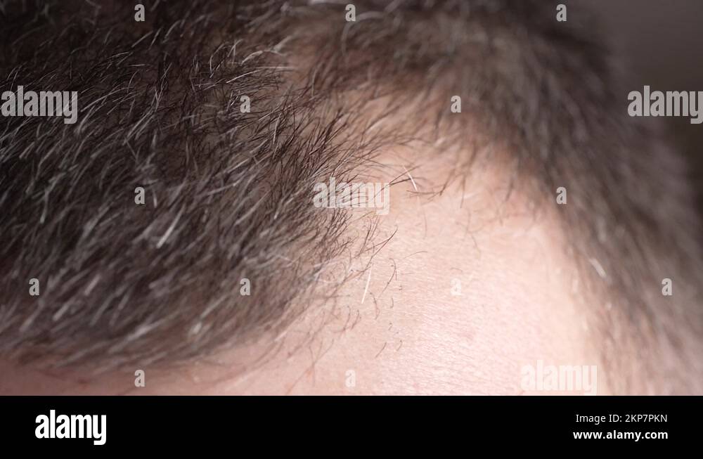 The beauty of a man. Macro hair of the scalp. A man's head in close-up ...