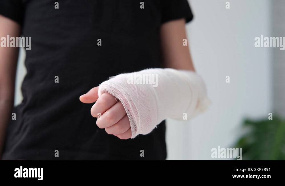 Wrist cast child Stock Videos & Footage - HD and 4K Video Clips - Alamy