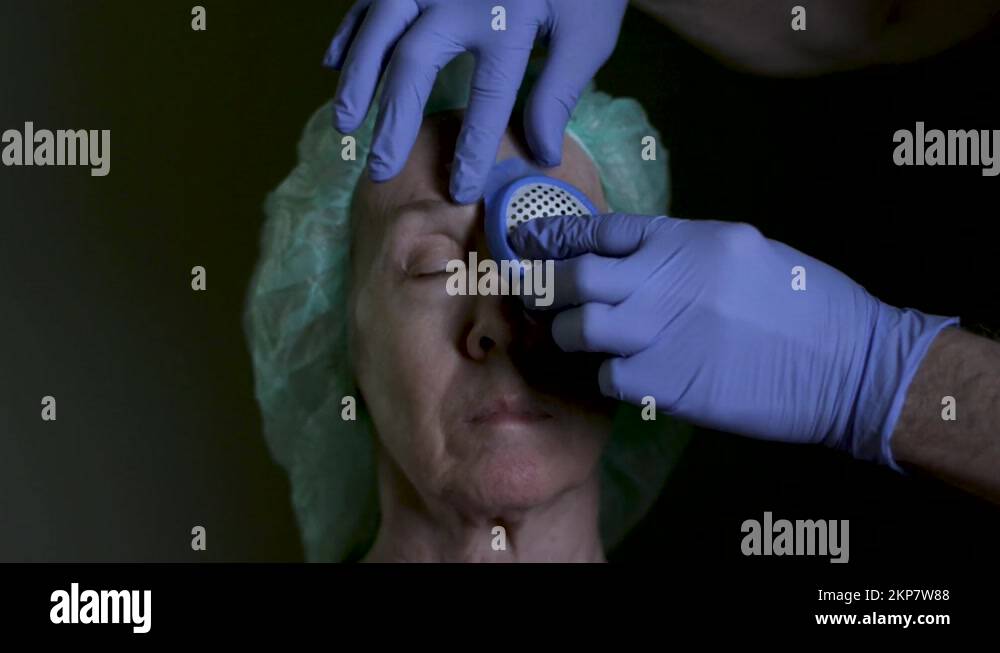 Cataract eye woman Stock Videos & Footage - HD and 4K Video Clips - Alamy