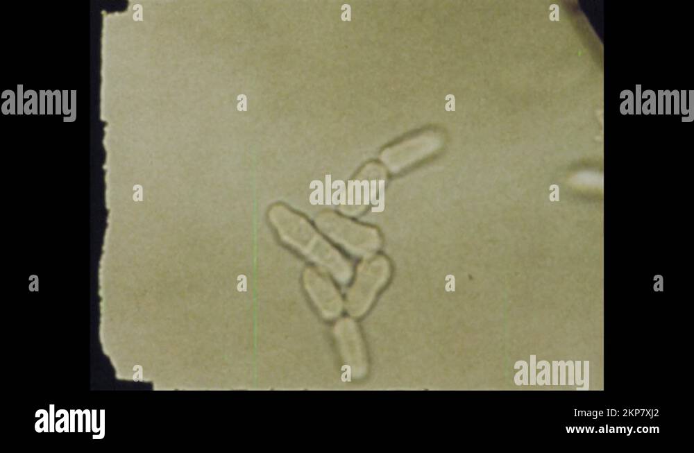 1970s Single Cell Fungus Under Microscope Time Lapse Of Bread Rising In Stock Video Footage