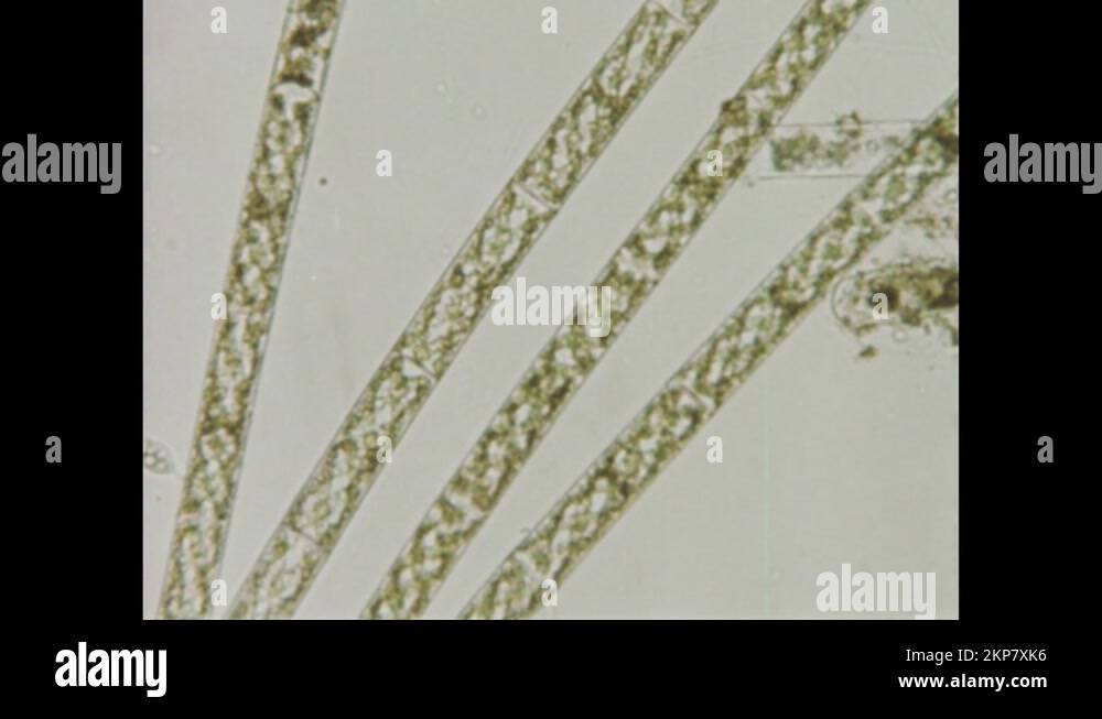 1970s green algae under microscope. Spirogyra algae. Colony of cells ...