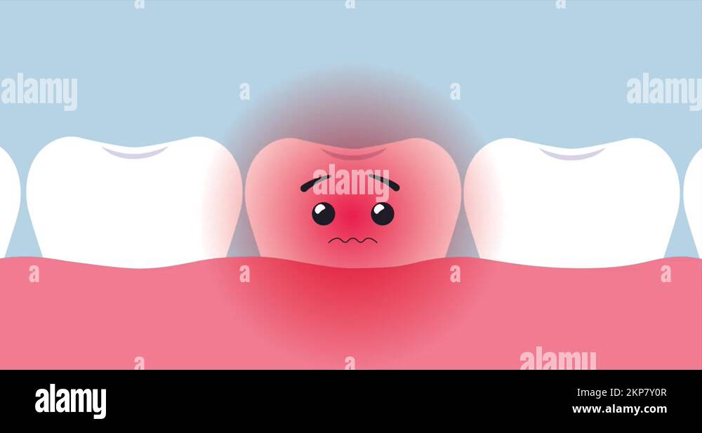 Cute tooth in pain. Toothache concept. 2D animation Stock Video Footage ...