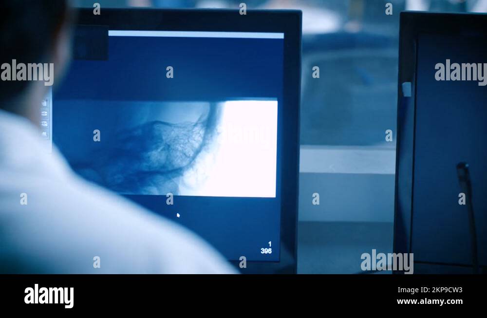 Hospital x ray fluoroscopy Stock Videos & Footage - HD and 4K Video Clips - Alamy