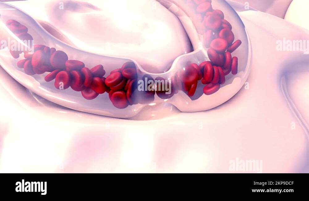 Bleeding blood vessel, animation Stock Video Footage - Alamy Bleeding blood vessel, animation Stock Video Footage - Alamy