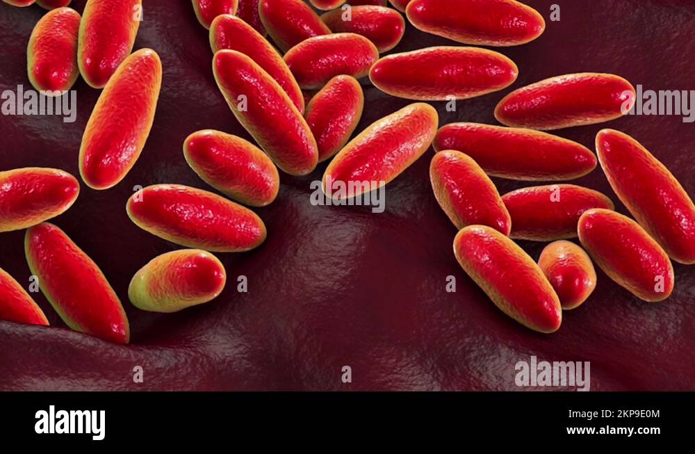 An infection by the bacterium yersinia pestis Stock Videos & Footage ...